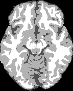 FANTASM: Fuzzy and Noise Tolerant Adaptive Segmentation Method