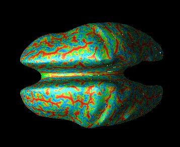 Finding the Brain Cortex Using Fuzzy Segmentation, Isosurfaces, and ...