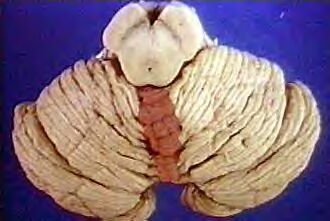 Vermis Definition - IACL