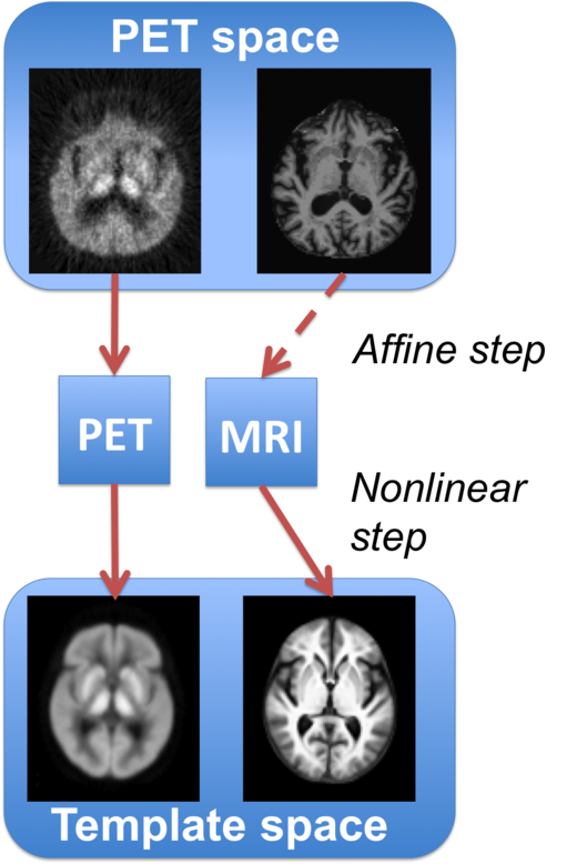 Deformation field correction for spatial normalization of PET images ...